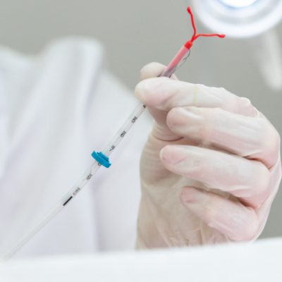 Understanding Mirena IUD Neurological Side Effects - OGOmed